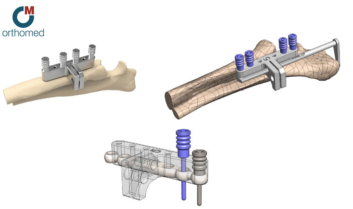 Wear vets first in UK in canine elbow replacement surgery